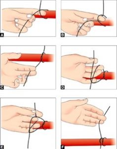 Types of Suturing: How to Choose the Right Suture Technique